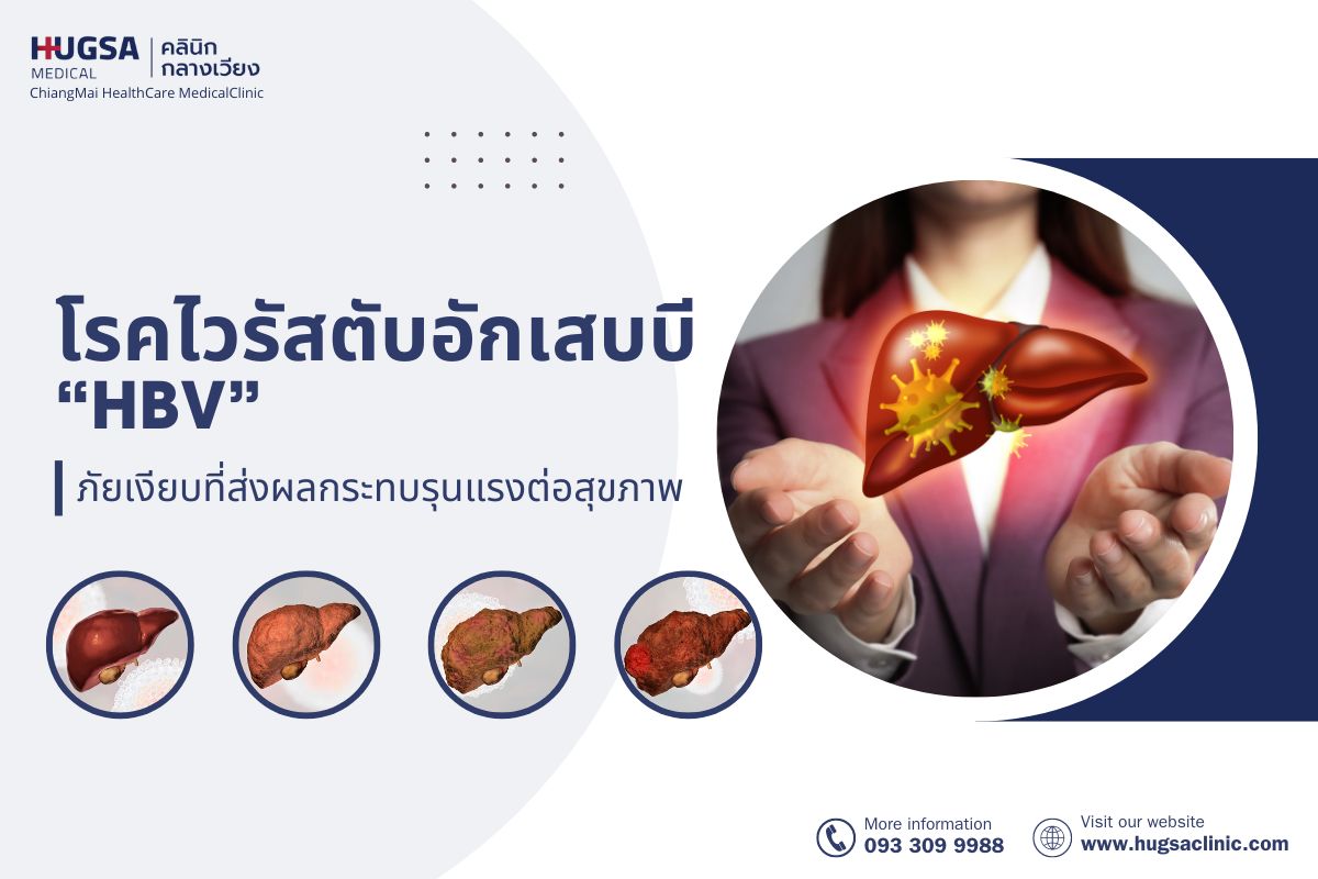 โรคไวรัสตับอักเสบบี (HBV) ภัยเงียบที่ส่งผลกระทบรุนแรงต่อสุขภาพ : ฮักษา ...